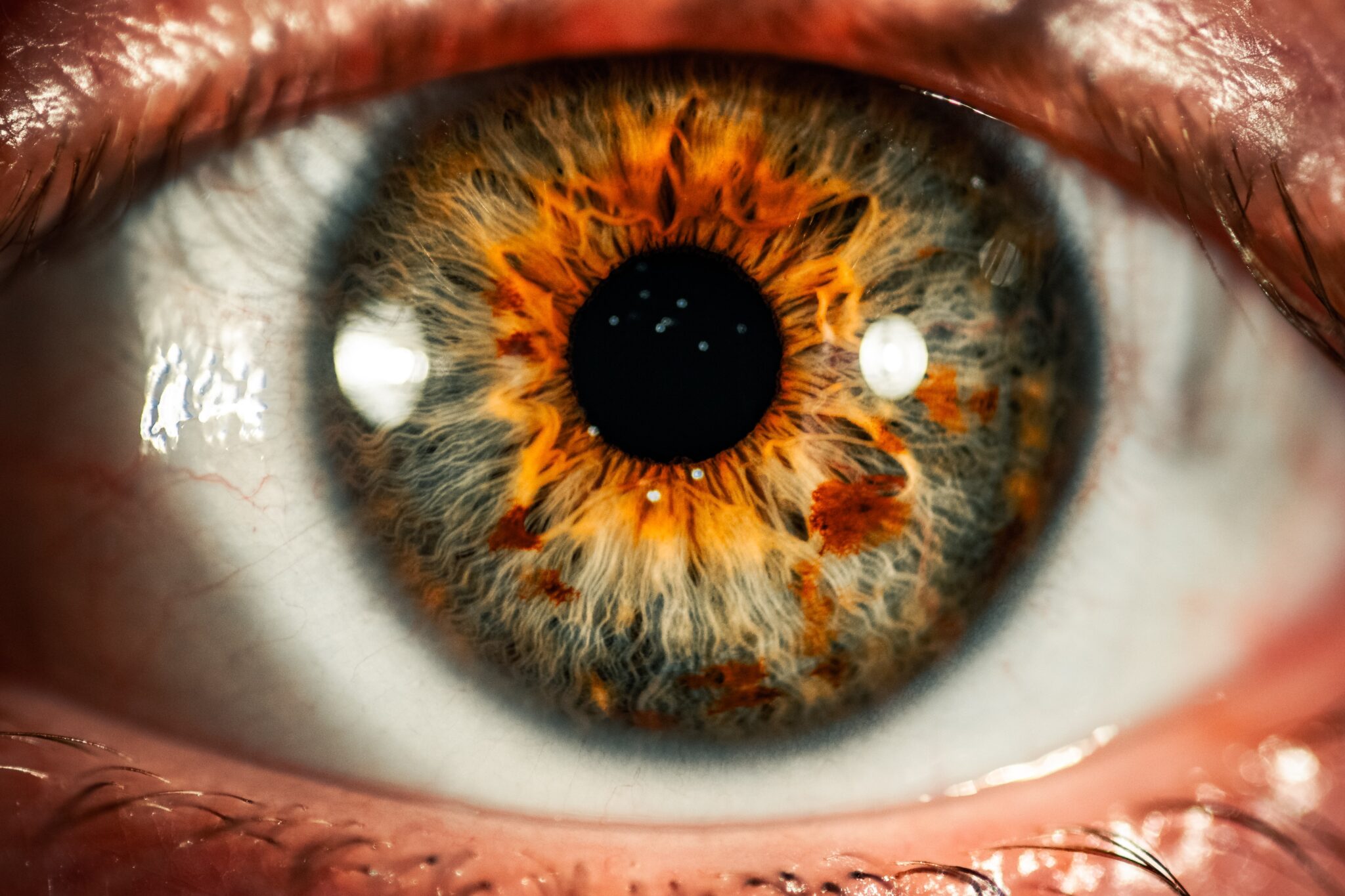 7 Reasons For Blurry Vision In One Eye Direct Personal Care